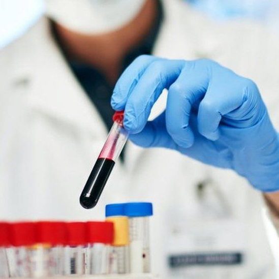 Verve Aesthetics – Facial Aesthetics in London